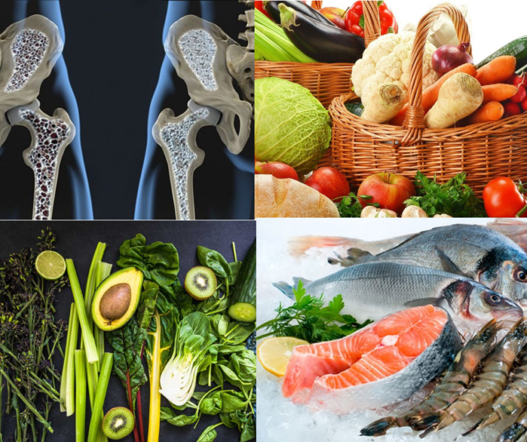 5 Foods That Support Bone Health - FemHealthLifestyle